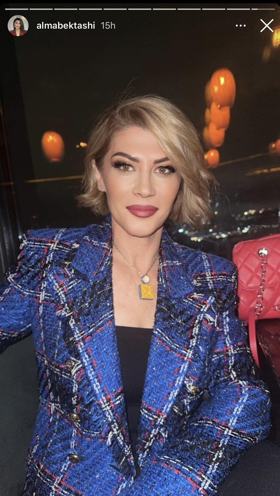 Çfarë i ndodhi fytyrës së Alma Bektashit pas ndarjes nga bashkëshorti ...